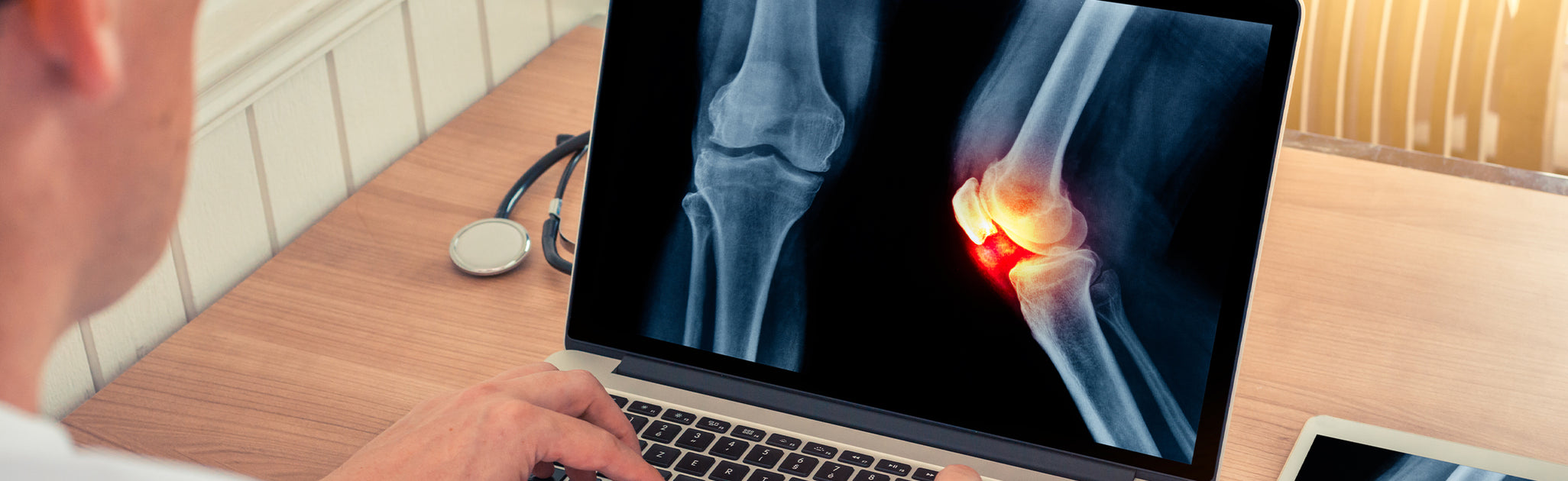 Core Products International Participates in Bone and Joint Health Nati